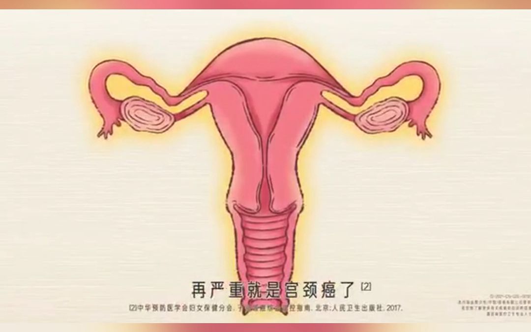 一分钟带你们了解hpv病毒感染是什么