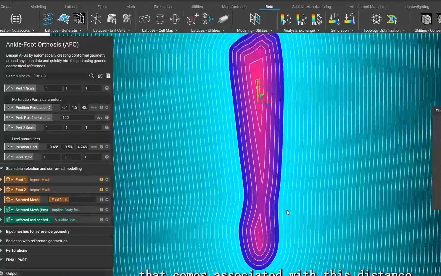 nTopology Live053 设计患者特有的踝足矫形器