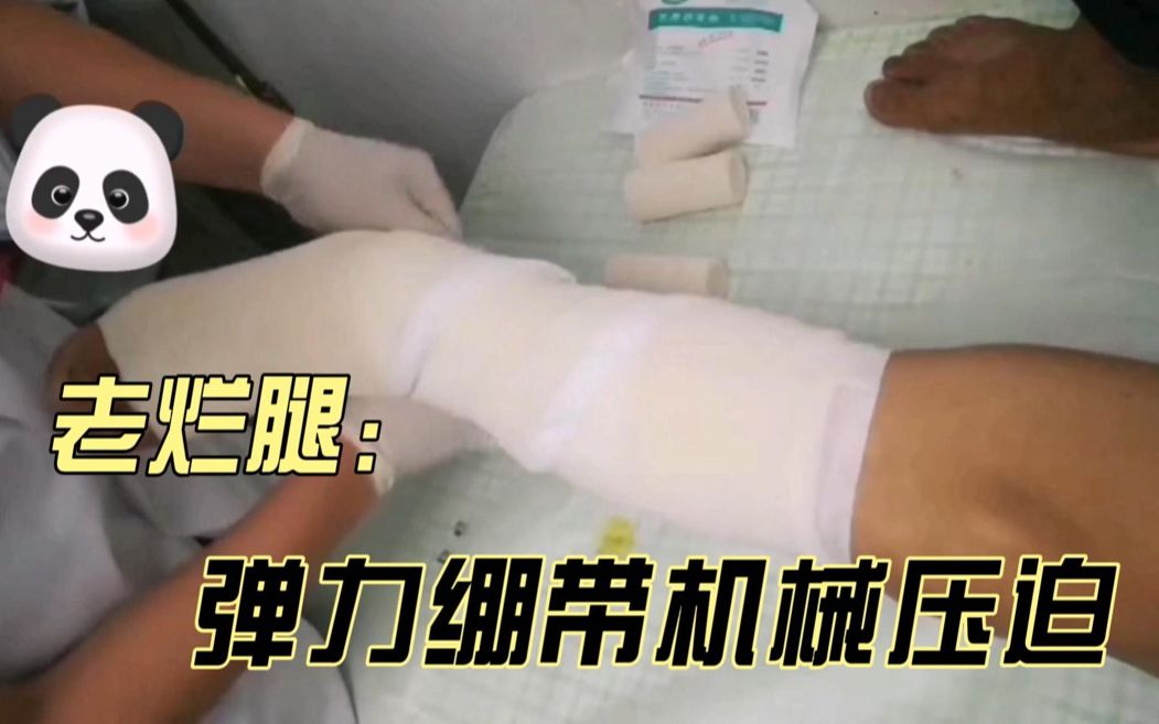 老烂腿不好怎么办?| 弹力绷带的压力治疗