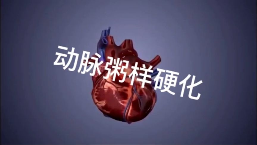 心脏 动脉粥样硬化动画视频