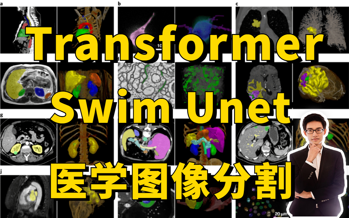 ...Transformer的医学图像分割实战,迪哥手把手带你精读论文并复现源码!
