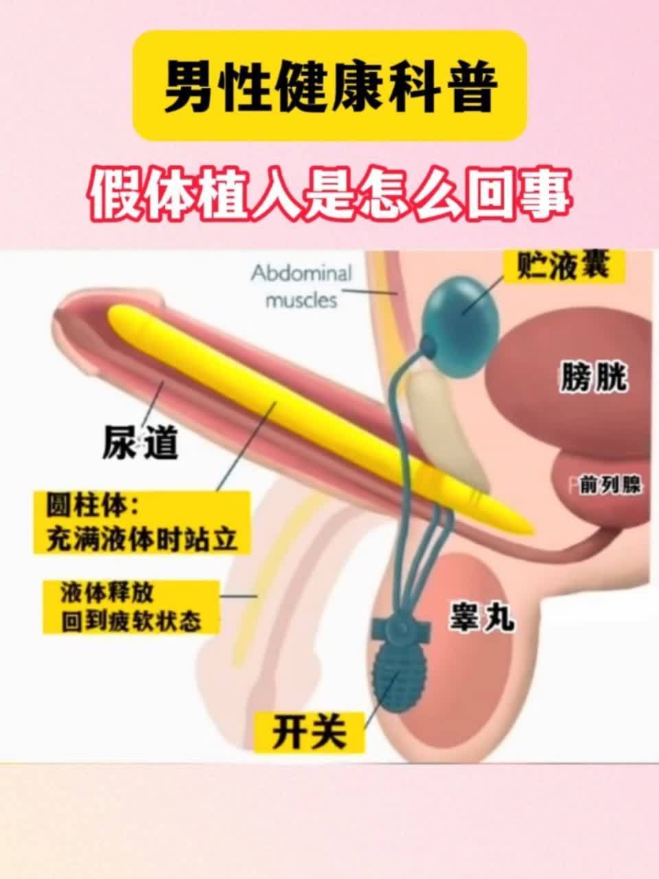 健康科普看看你了解多少#科普一下 #养生知识 #普及知识
