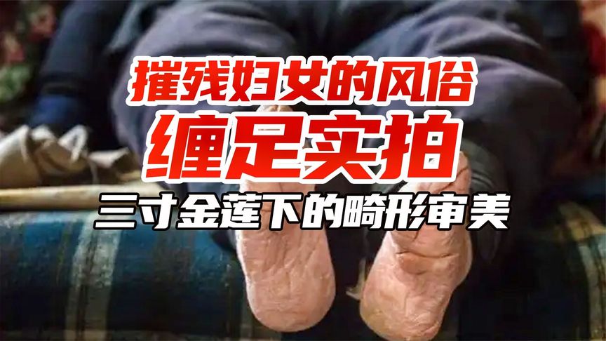 实拍记录摧残妇女的缠足风俗,反人类的古代陋习为何延续数千年?