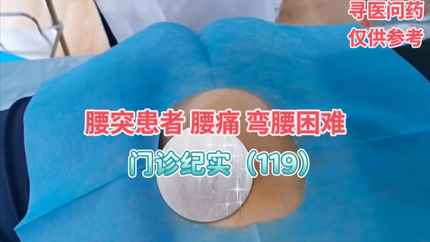 王女士腰椎间盘突出腰痛弯腰困难骶管裂孔注射疗法