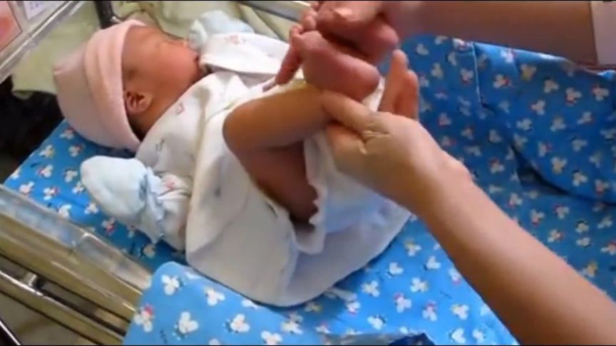 妇产科专业护士教你怎样给新生儿宝宝换尿不湿