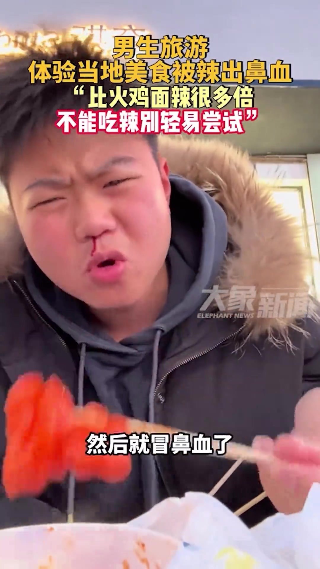 男生到陕西榆林旅游,体验当地美食被辣出鼻血:比火鸡面辣很多倍