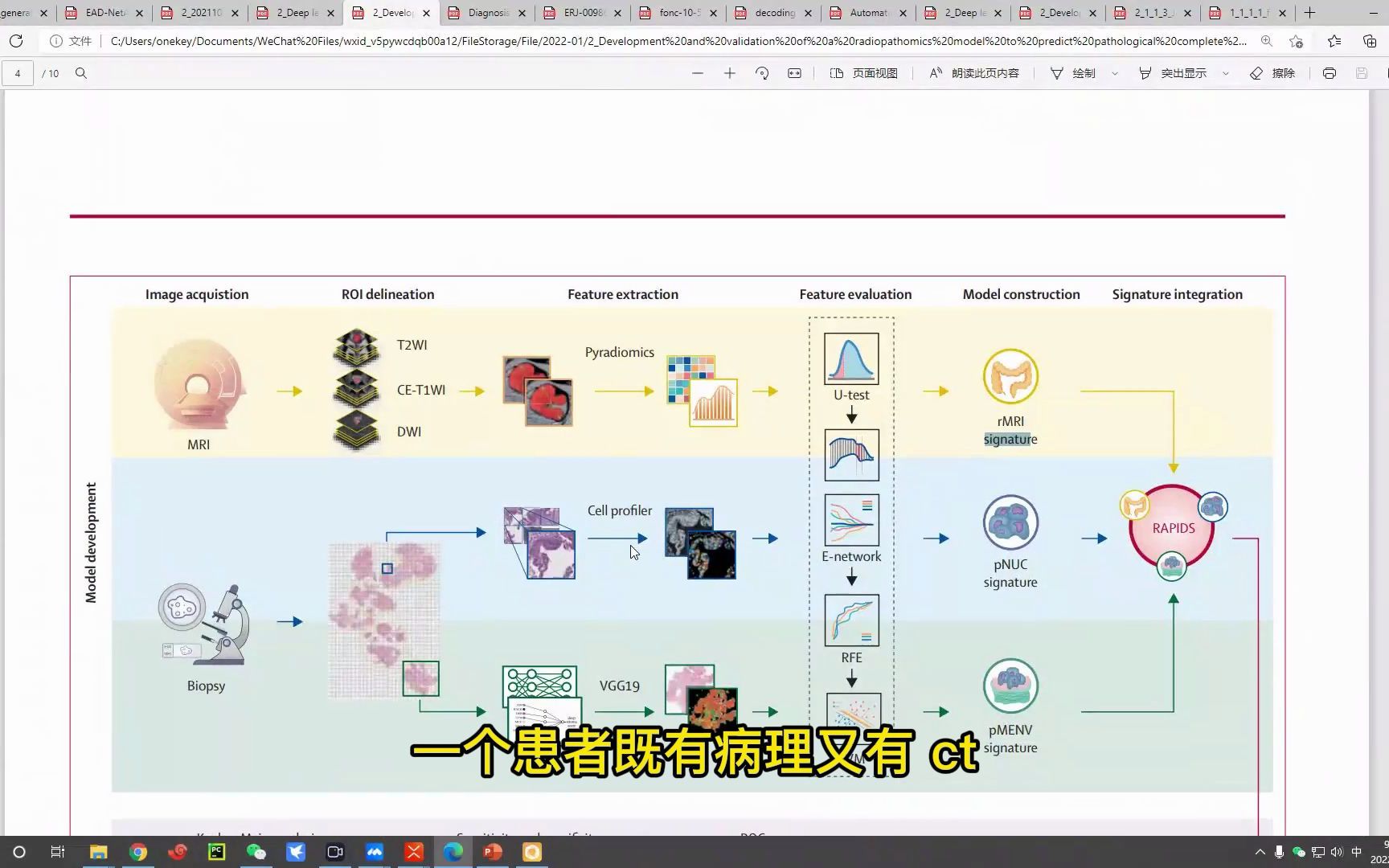 如何快速实现结构化数据转化在脑肿瘤诊断中的研究应用