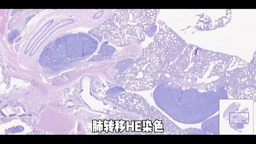 肺转移HE染色#he染色 #染色外包 #动物实验外包