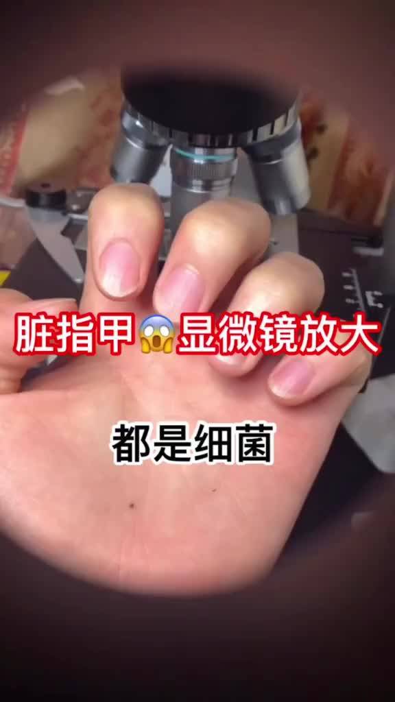 指甲放大千倍以后竟然发现这么多细菌。