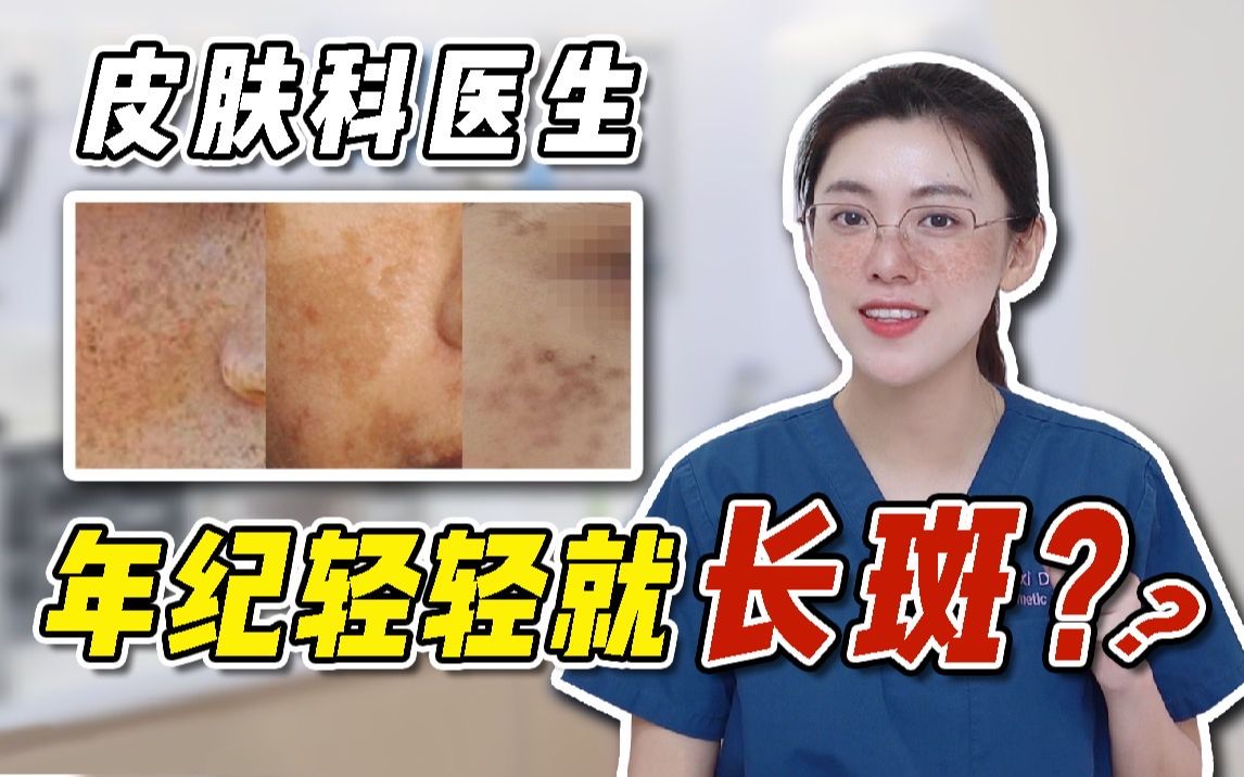 关于22岁就长斑这件事,皮肤科医生有话说!