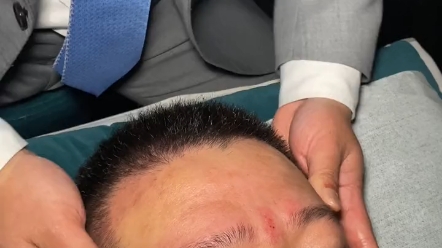 正装男士头疗头部按摩点印堂开天门推坎宫点按神庭至百会穴,睛明穴...