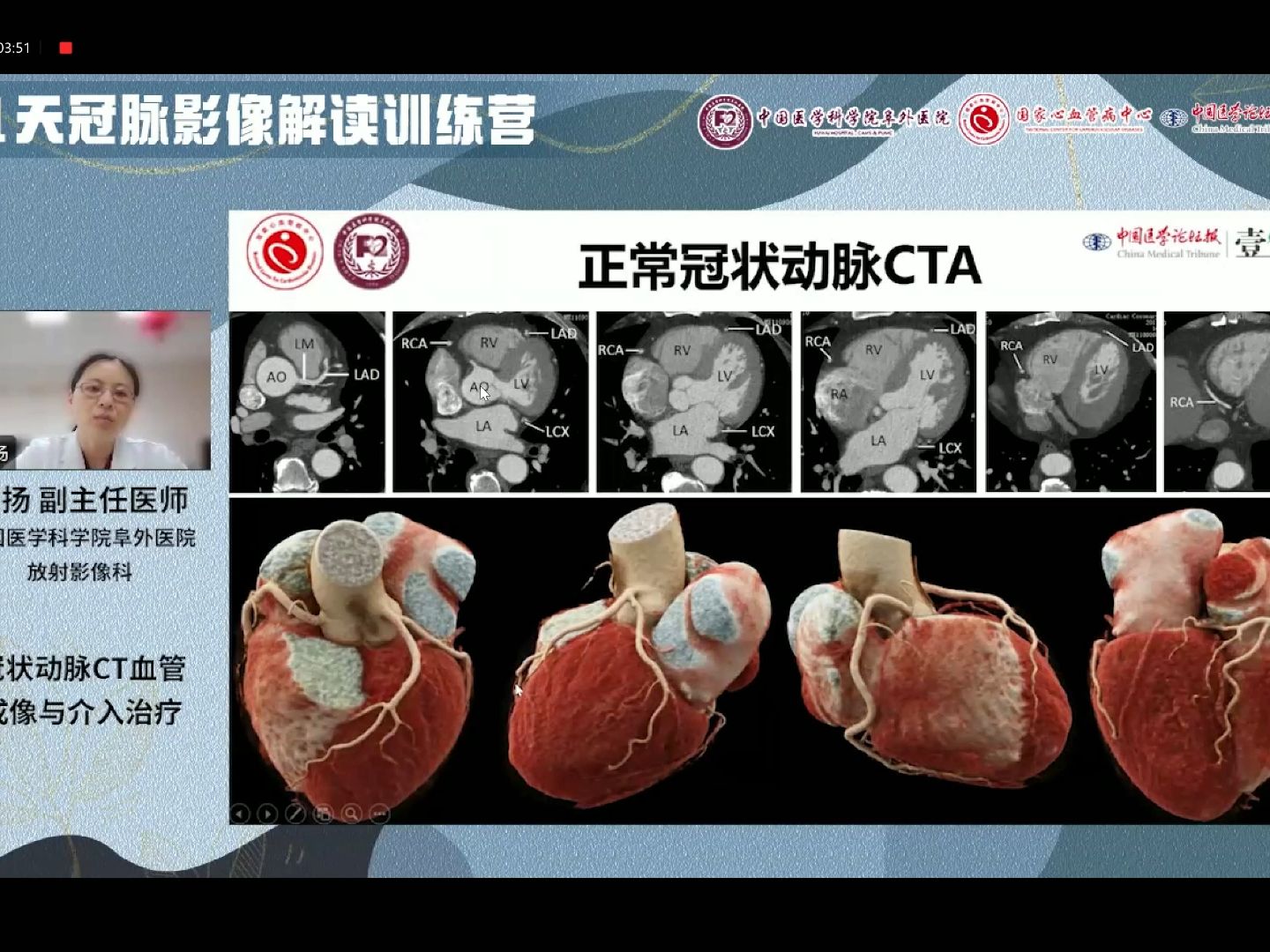 高扬:冠状动脉CT血管成像与介入治疗