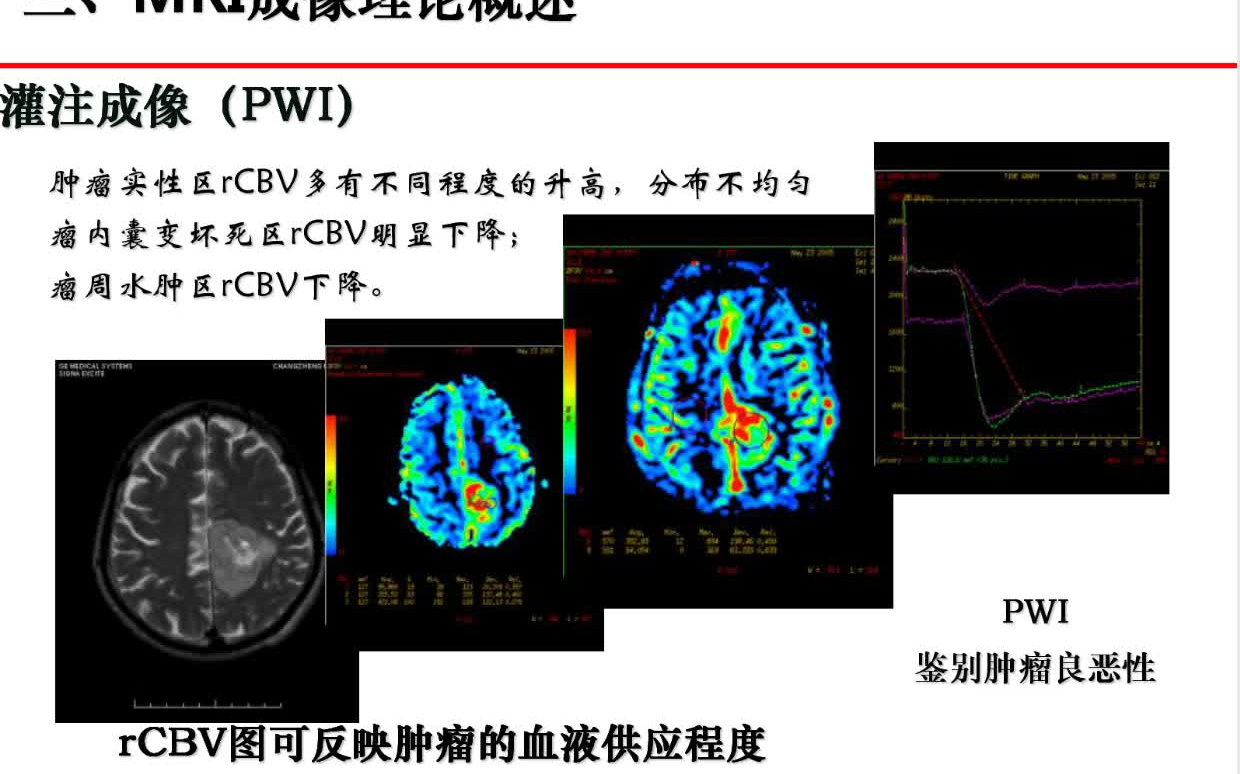 中枢神经系统影像诊断