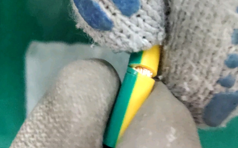 包皮环切术!