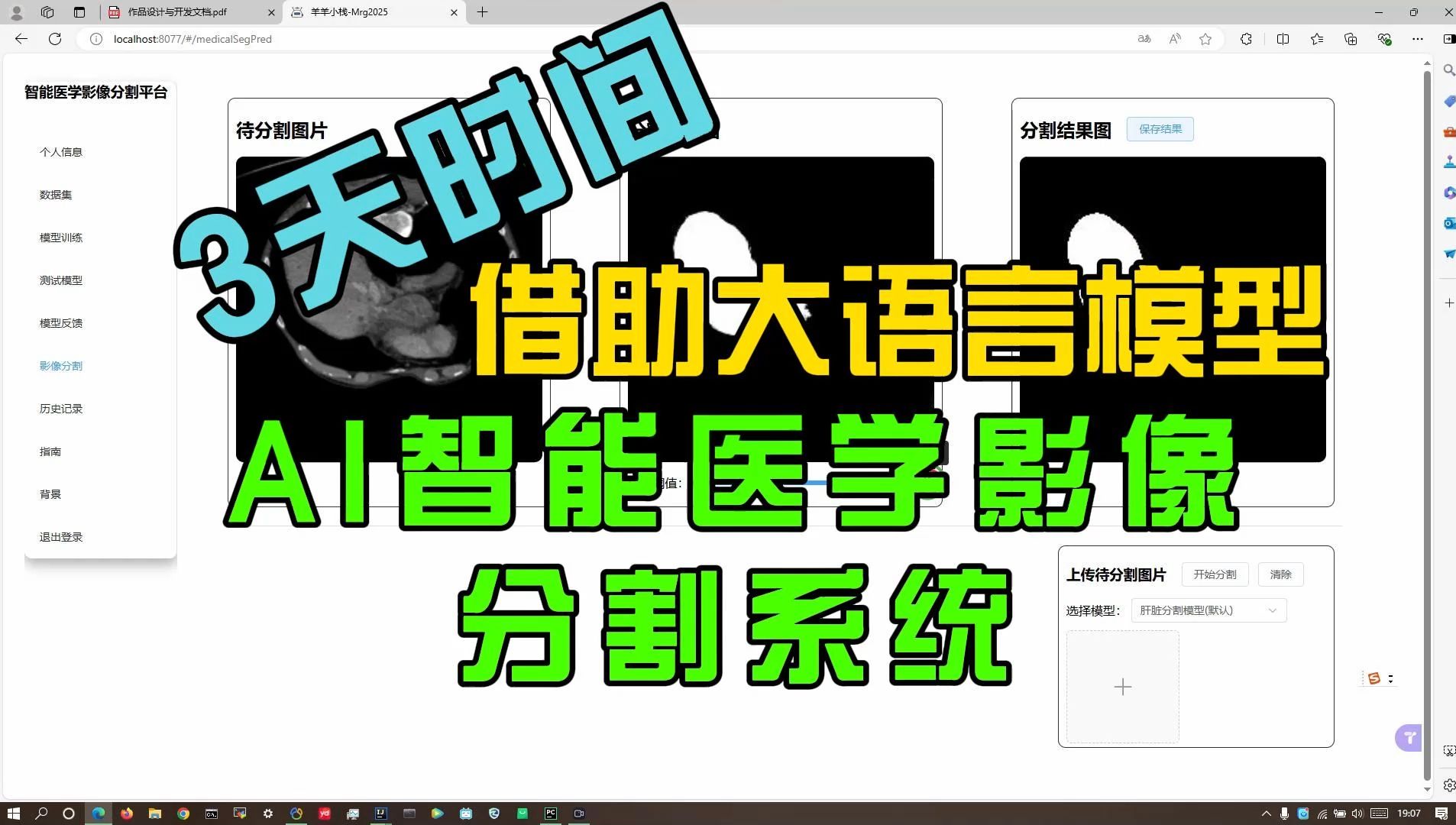 vue+flask+springboot+pytorch借助大语言模型实现的医学影像分割系统
