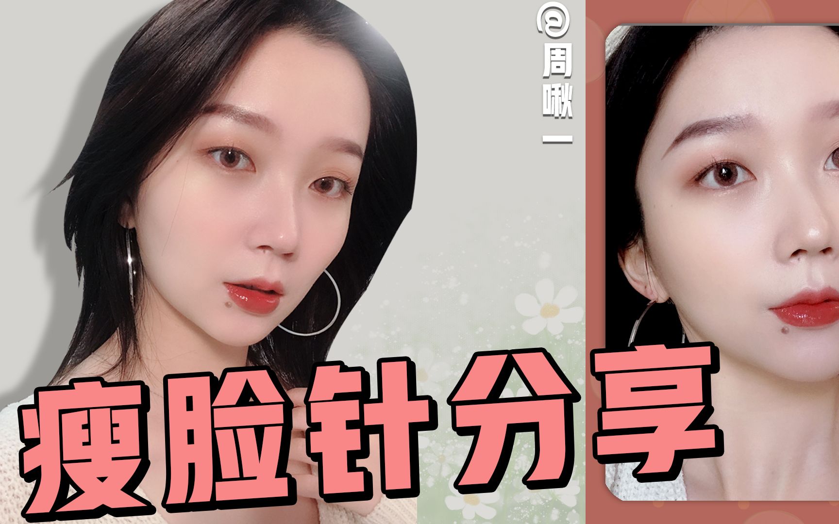 瘦脸针分享!0废话!超全面!流程+Q&A!