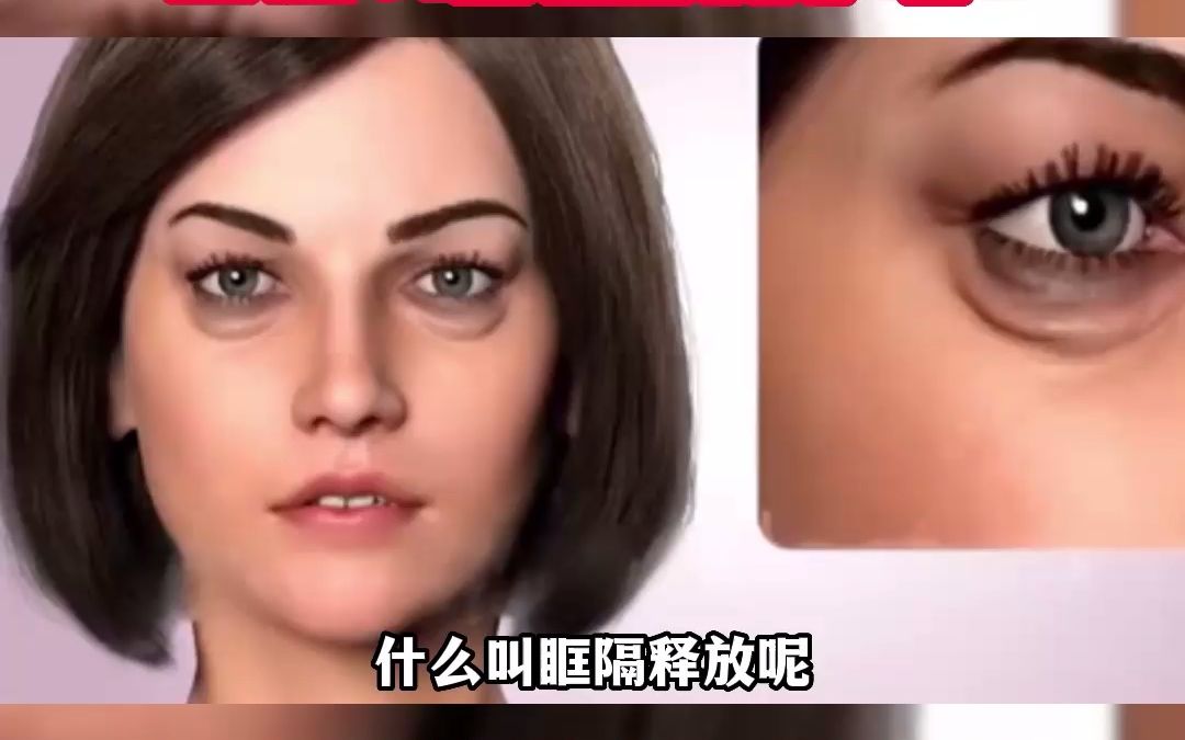 10秒动画视频演示,什么是眶隔释放,眼袋又是如何去除的