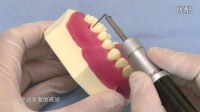 超声牙周刮治技术操作示范