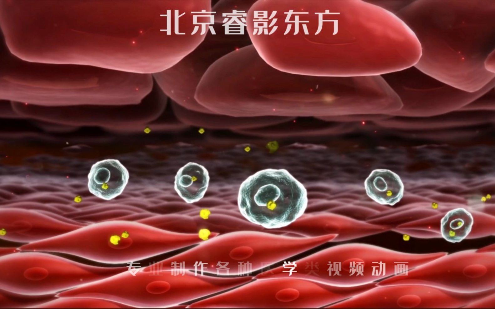 动脉粥样硬化动画剪辑