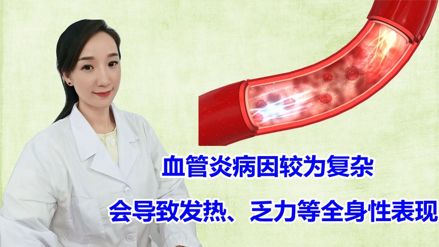 血管炎病因较为复杂,患病后会导致发热、乏力等全身性表现