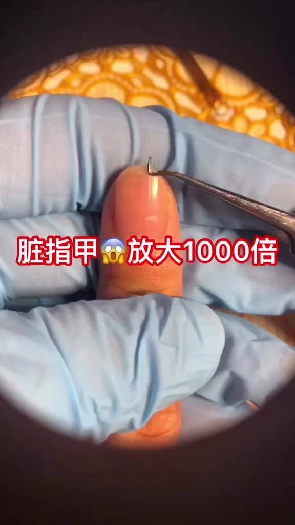 指甲放大以后竟然这么多细菌,真后悔小时候啃指甲