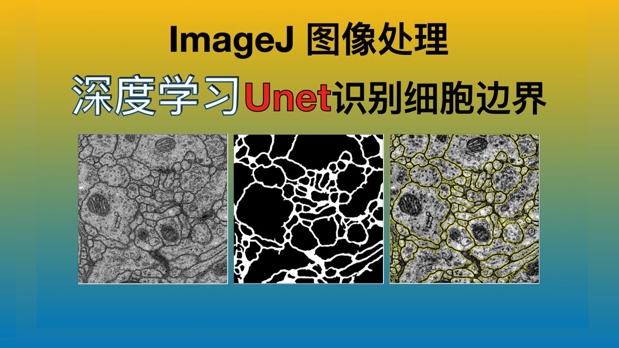 『超实用』ImageJ图像处理 - 深度学习Unet区分处理识别细胞膜 Deep...