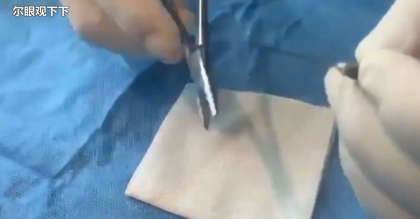 援湖北医生用头发丝帮同事缝伤口:缝合的针线太粗