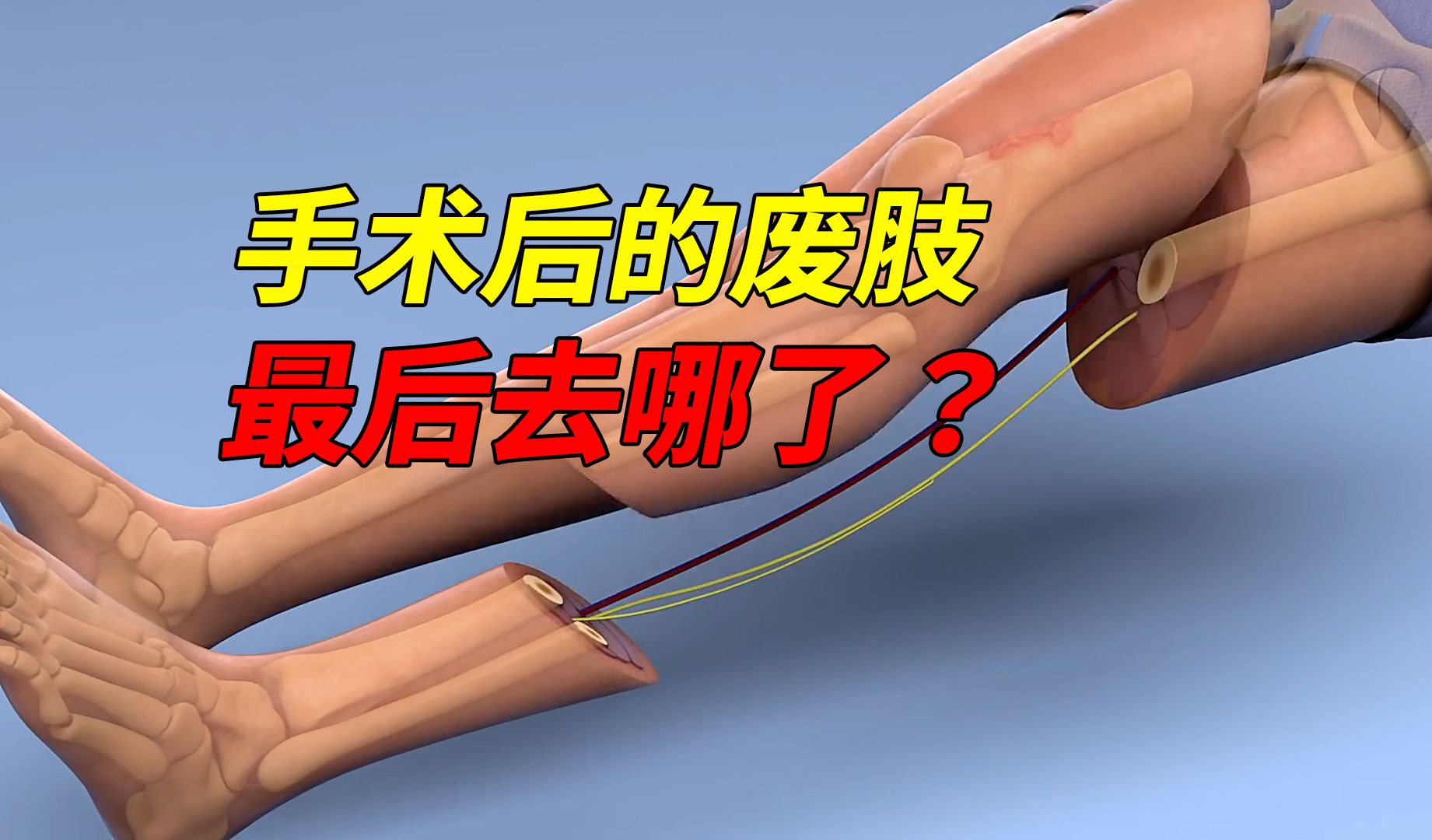 医院里手术切下来的人体器官,最后都去哪了?