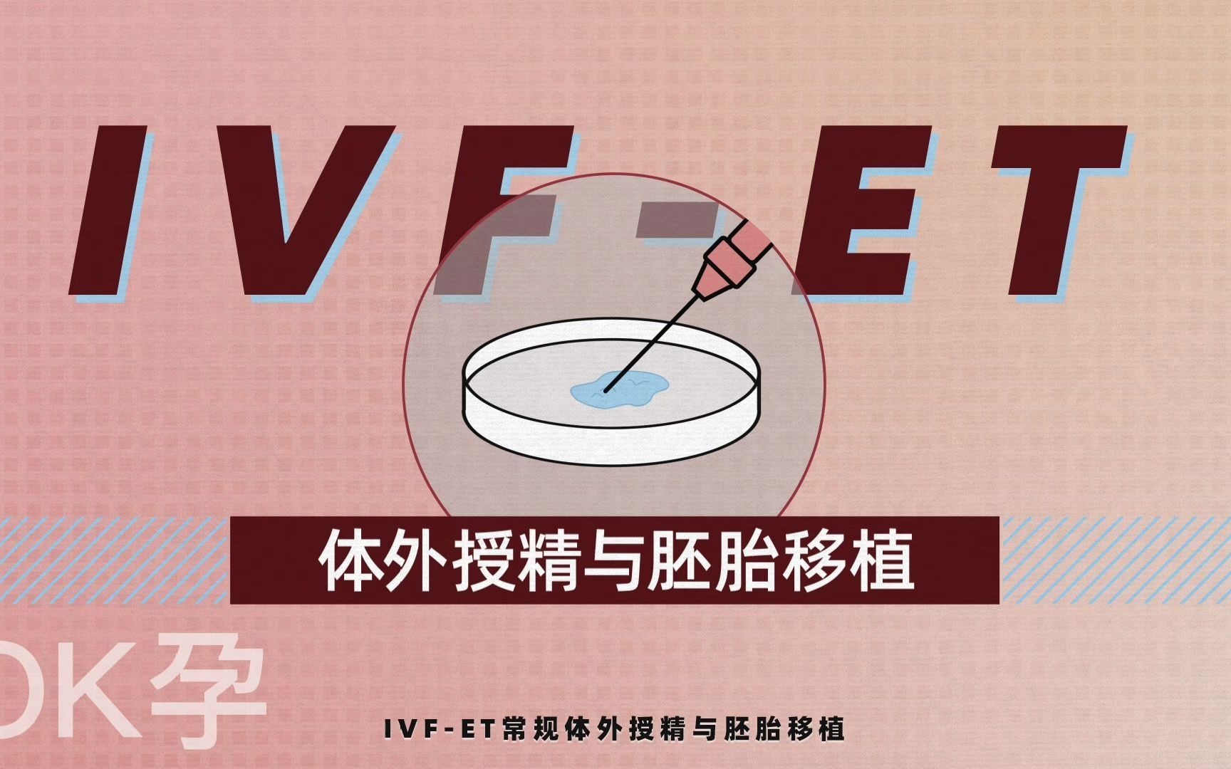 【3D动画】试管婴儿的一代/二代/三代技术,让你清晰明白!