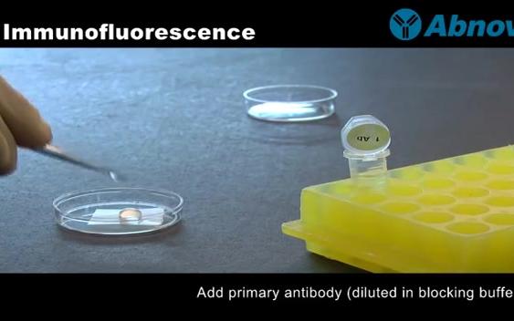 细胞免疫荧光 Immunofluorescence
