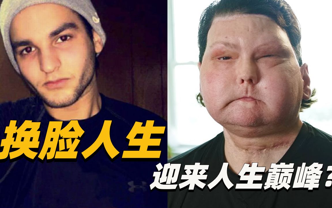 一场事故,他失去了脸部。新的面孔带来了新的人生和爱情!世界面部和...