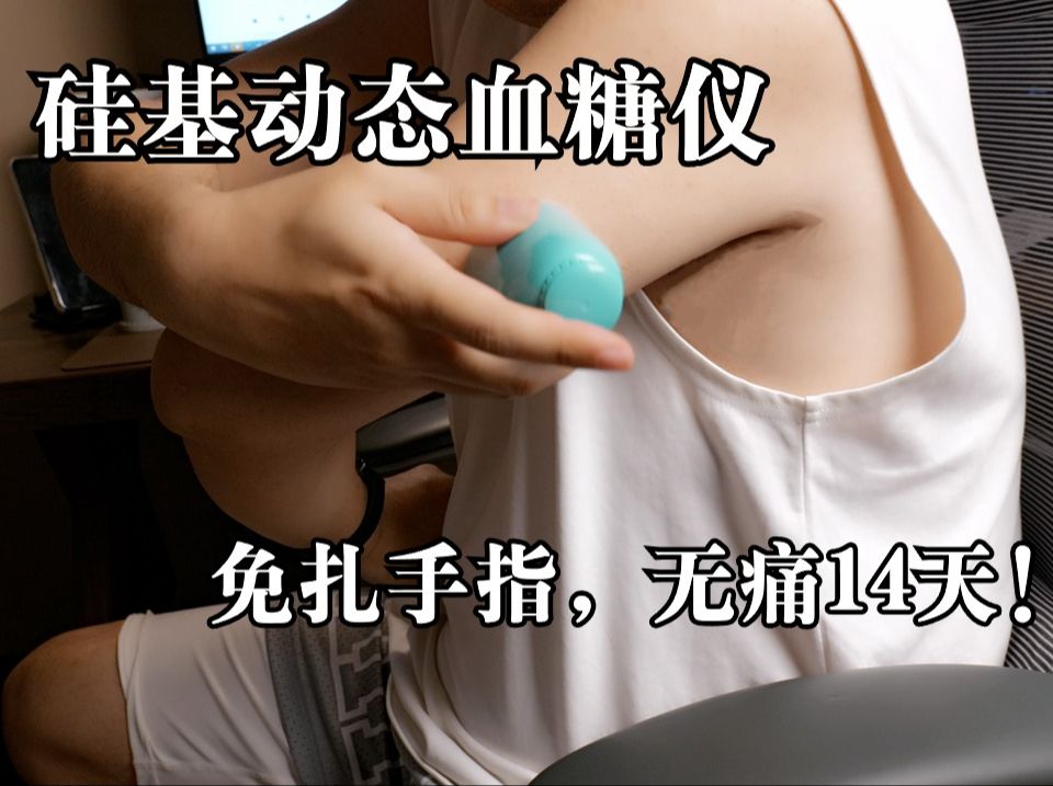 探索赛博式新科技,如何用动态血糖仪管理你的健康生活!