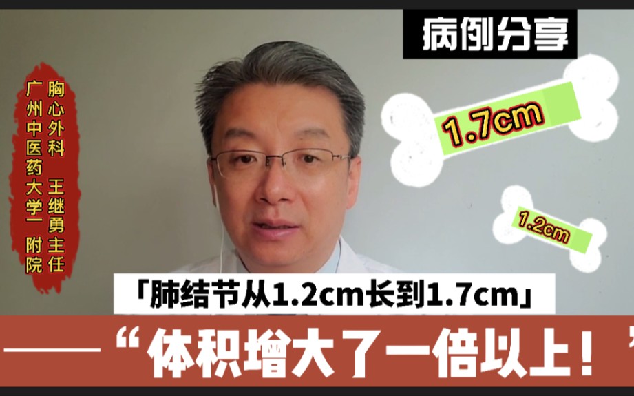 肺结节只增大了0.5cm,但体积却增加一倍不止!大家要警惕起来!