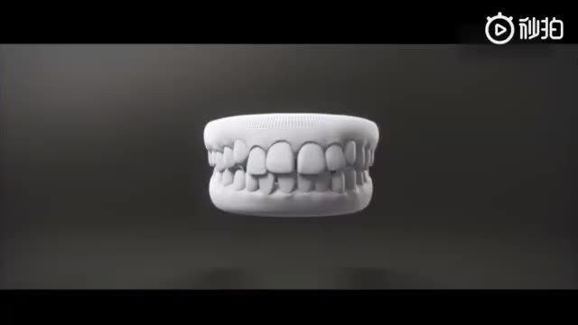 正畸itero口扫仪-告别传统取模的不适和漫长等待