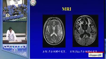神经病学 9 中枢神经系统感染
