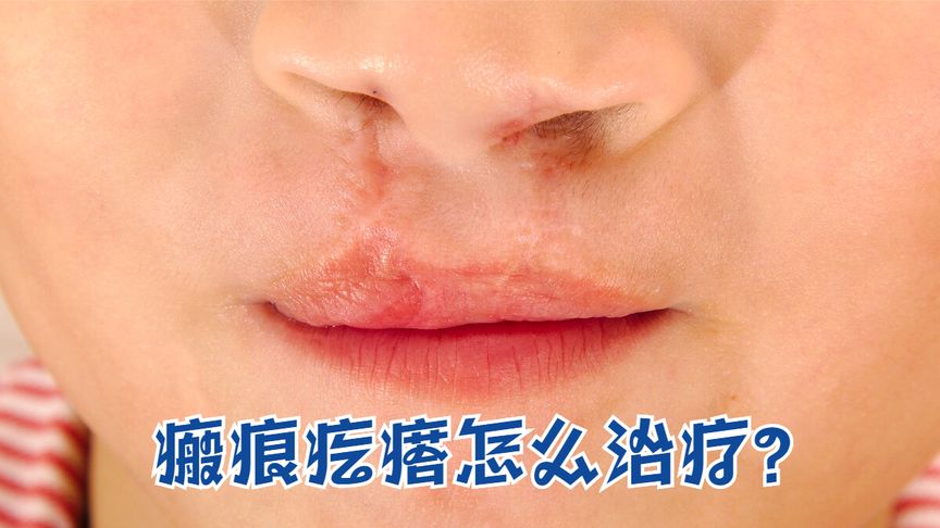 想快速消除疤痕疙瘩?药师教你一招,简单有效!