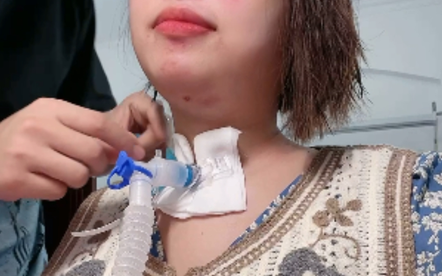 气管切开男朋友在家帮我换套管全过程,胆小勿入(不建议病友们轻易尝试)