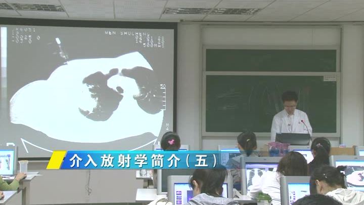 【放射诊断学】数字减影血管造影-介入影像学 (5)
