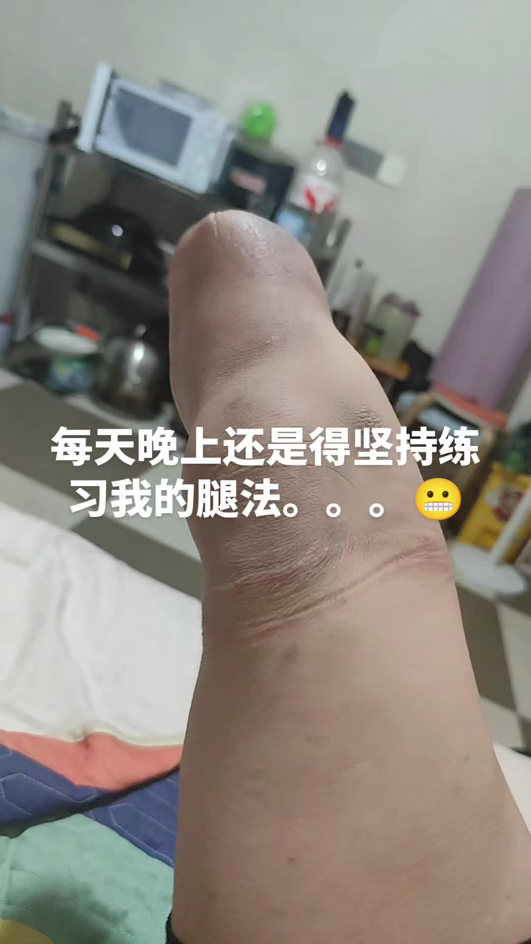 每天晚上还是得坚持练习我的腿法。ߘ�#截肢#假肢#残疾人