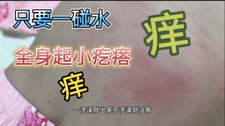 这皮肤怎么了只要一碰水,起红疙瘩包包,孩子痒的好揪心难受