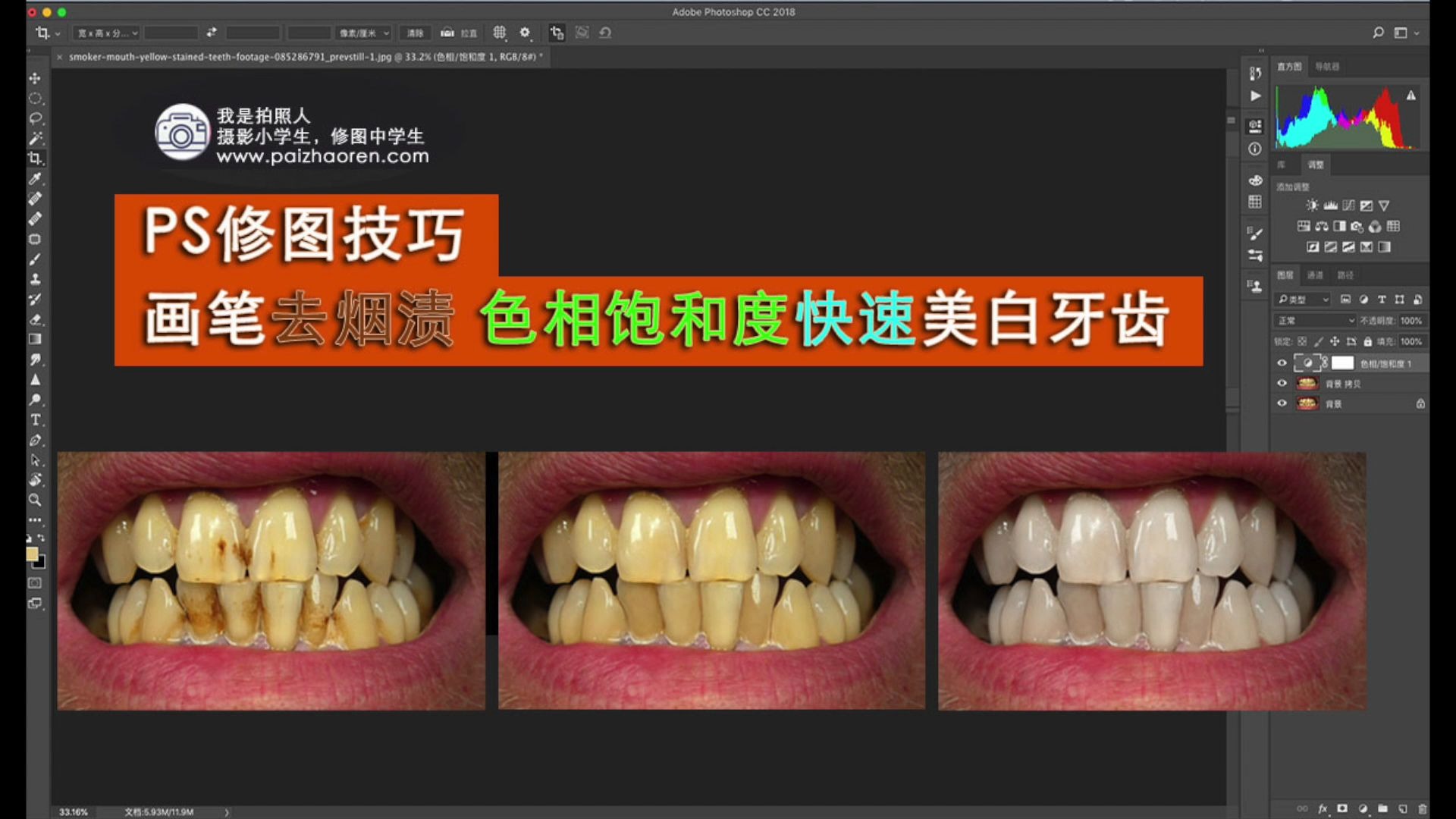PS修图教程 画笔去牙渍 色相饱和度美白牙齿
