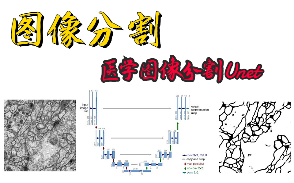 ...本来挺喜欢上图像分割课程的,计算机博士教我从入门到医学图像分割...