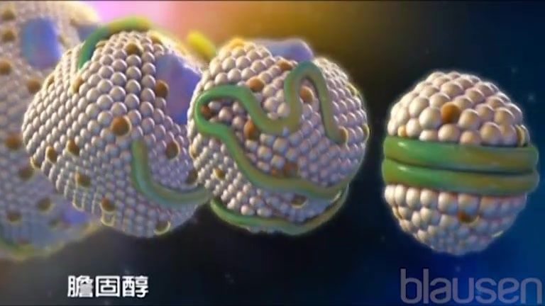 医学3D动画演示:高脂血症与动脉粥样硬化