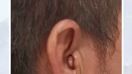 助听器正确佩戴效果图