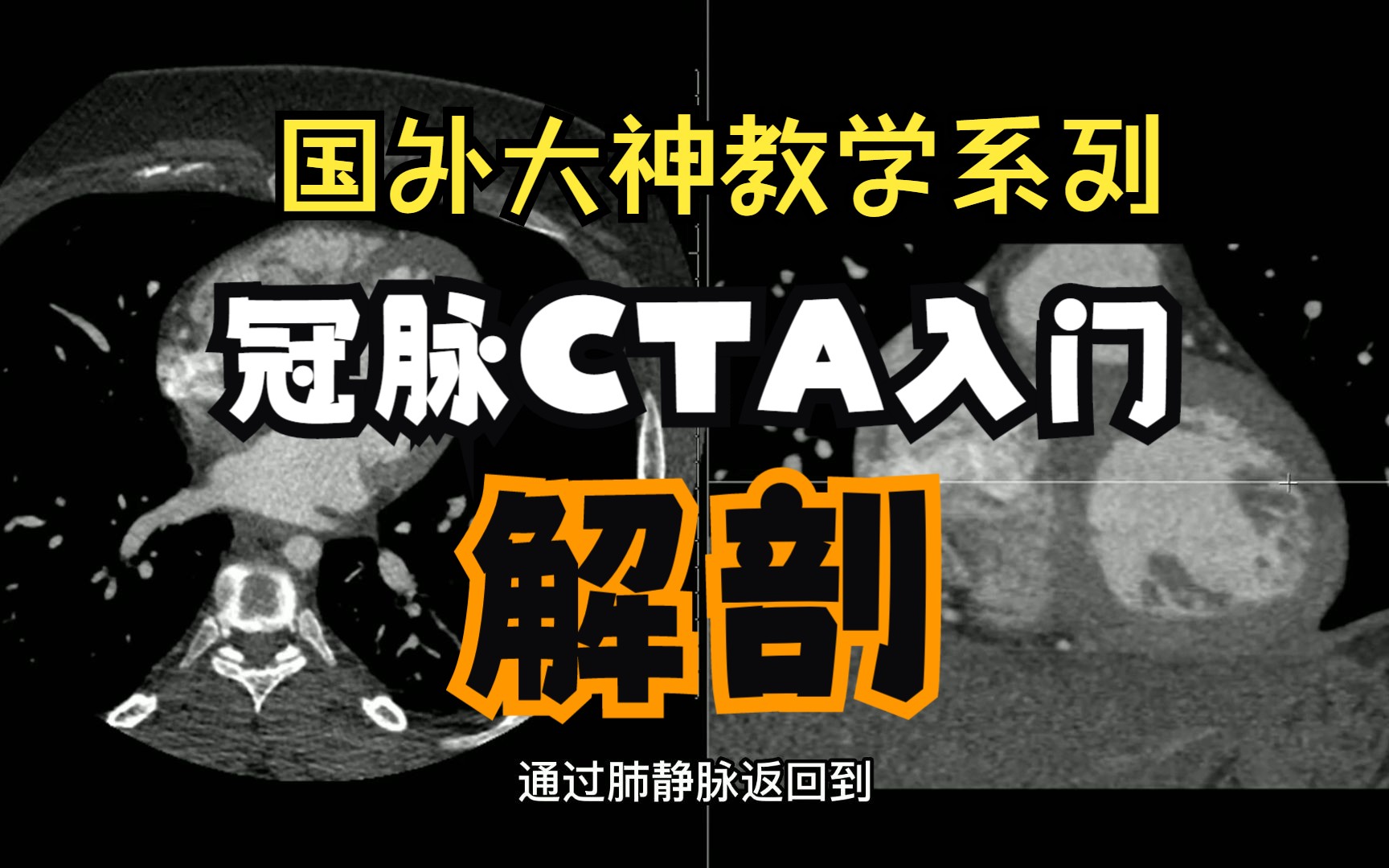 冠脉CTA入门解读—解剖(国外大神教学系列)