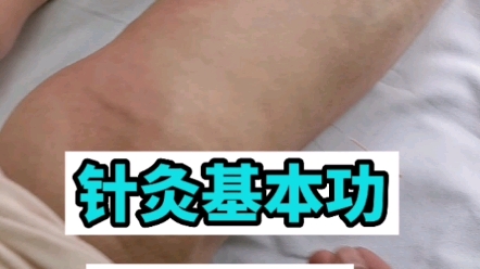 针灸基本功——单手取针