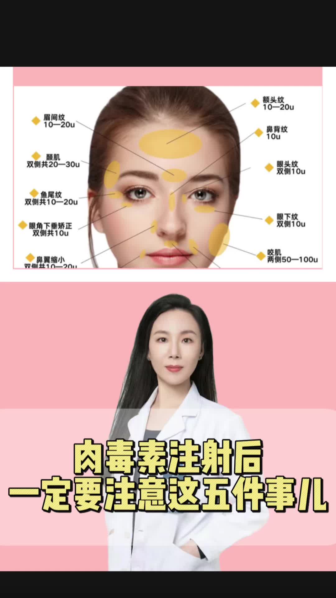 打完肉毒素一定要注意这五件事儿!#肉毒素 #肉毒素注射 #抖出健康...