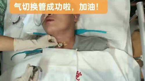 昏迷促醒成功,呼吸机脱机成功,气切插管换管成功,下一步封管,走回家