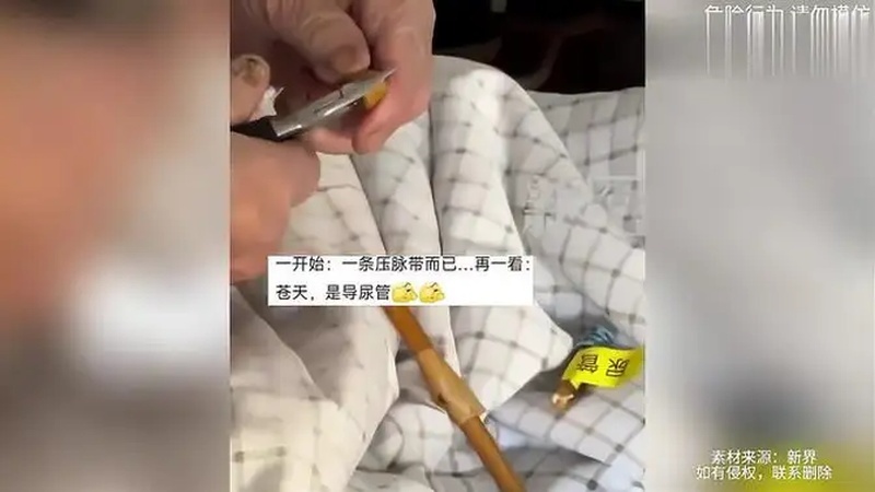 老人住院一个月自己偷偷割导尿管,称割断就不会再插了