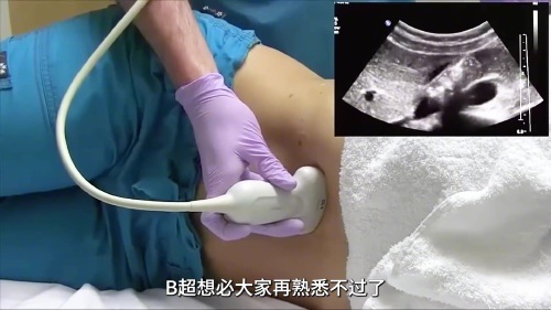超声波真可谓是"全能医生",来看下它在我们身边的一些应用!